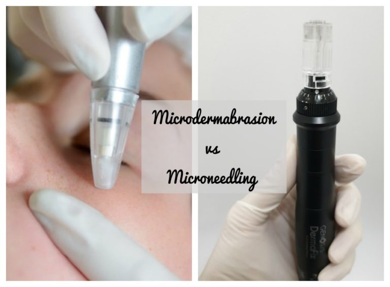 Microdermabrasion vs Microneedling - Which One Should You Choose?