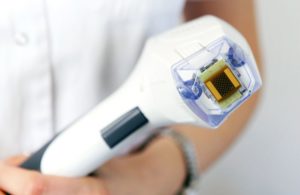 6 At-Home Best Radio Frequency Skin Tightening Machines