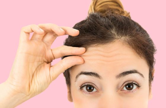 How to Make Your Forehead Smaller Naturally: 11 Ways